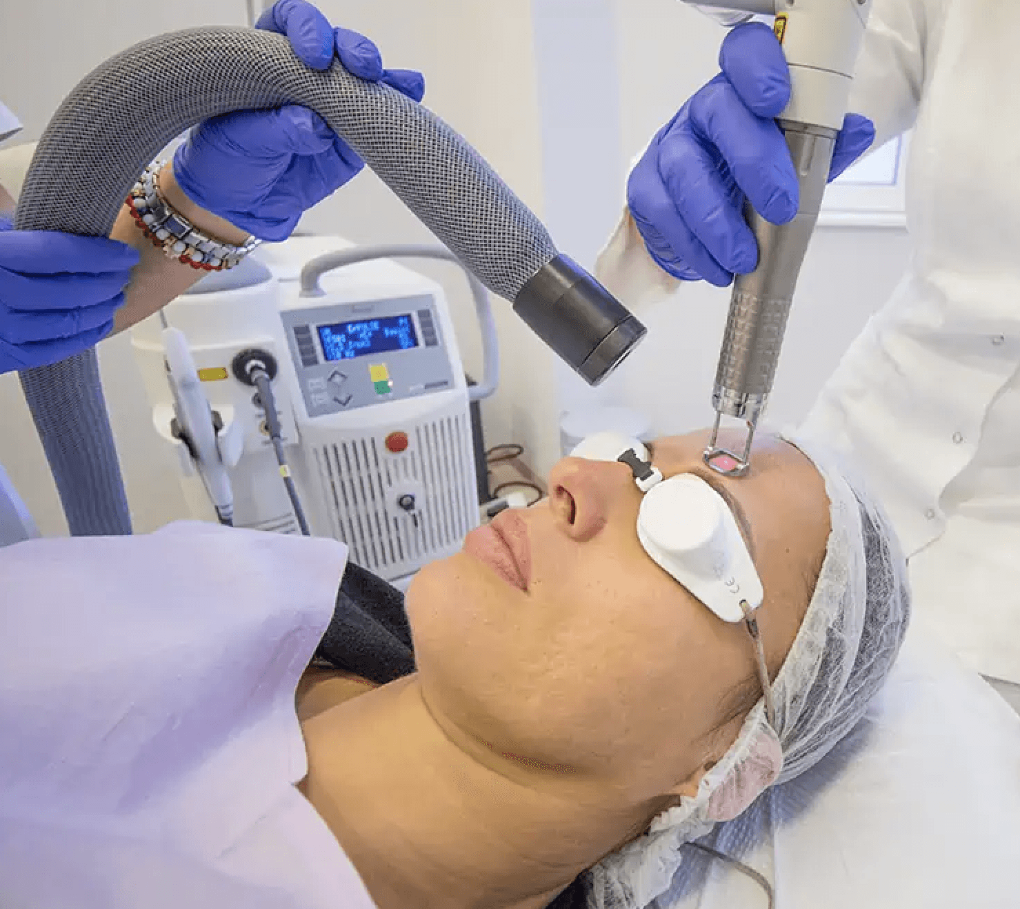 Lasersko uklanjanje ožiljaka u Beogradu I DIVA Medical